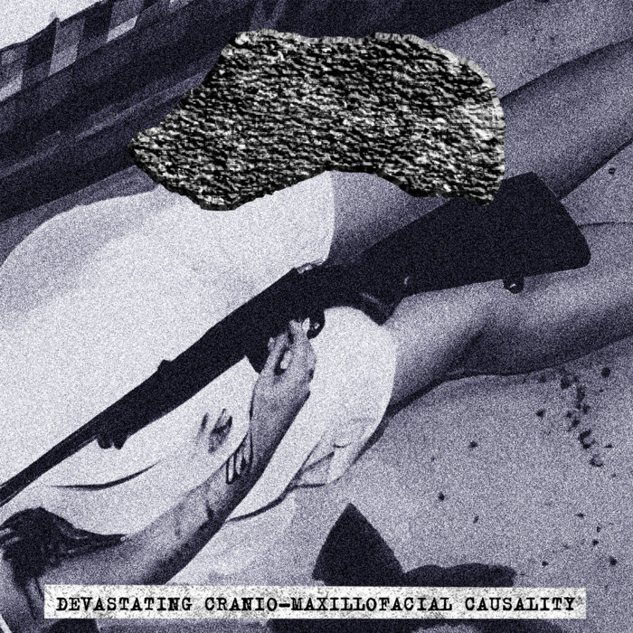Devastating Cranio-Maxillofacial Causality | Septic Abrasions ...