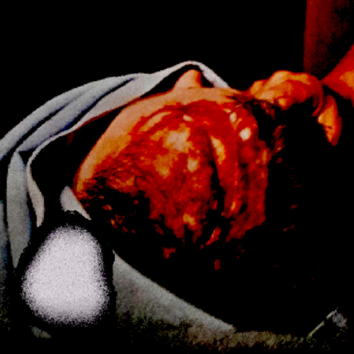 Cranial Lesion Caused By Nausea | TxLxFxSxDxSxPxExDxH | Cleansed Corpse ...