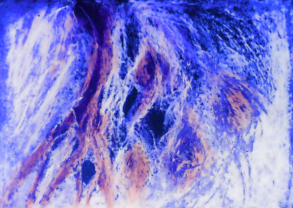 NORTHBERRIES | coshma lynn & kapela zbiory specjalne | malin