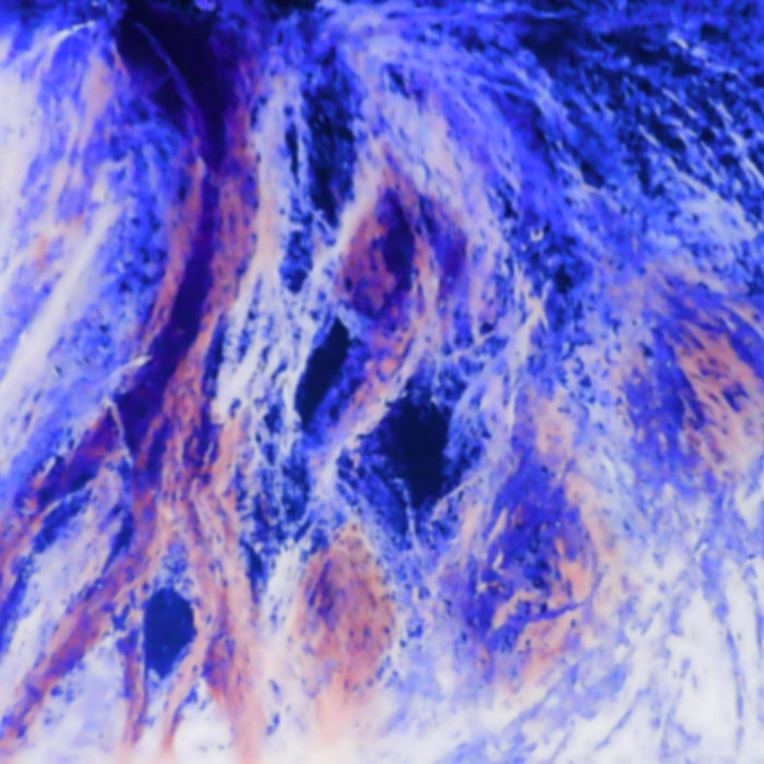 NORTHBERRIES | coshma lynn & kapela zbiory specjalne | malin