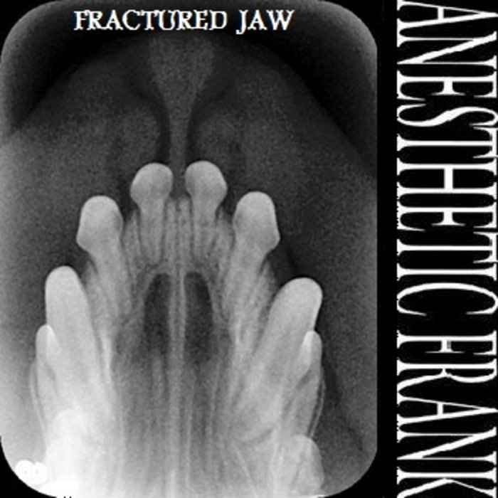 Fractured Jaw EP | Anesthetic Frank