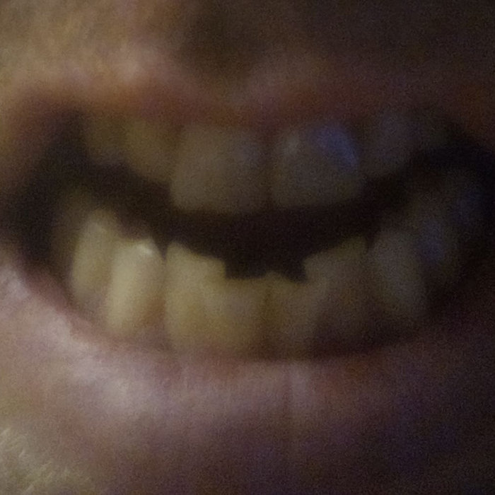 Jeff Unfortunately 'heres a picture of my teeth' | Spaghetti Tapes