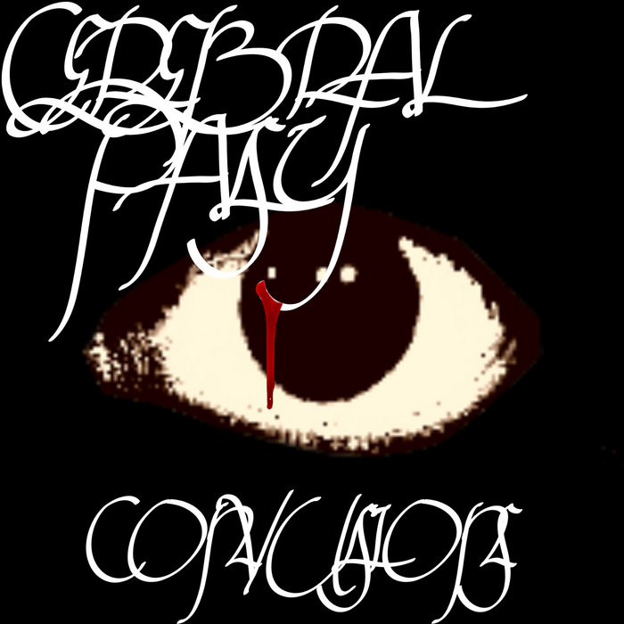 CONVULSIONS SINGLE CEREBRAL PALSY convulsions-single-cerebral-palsy