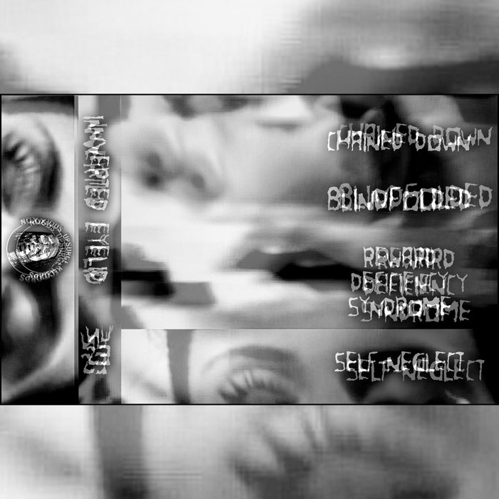 Inverted Eyelid | Inverted Eyelid | Noxious Upsurge