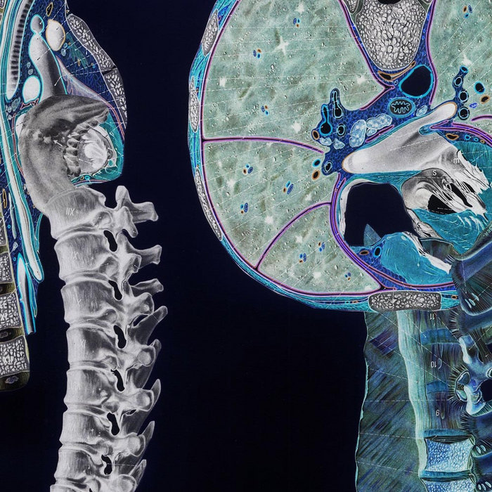 The Circus Of Unintelligent Life Forms And Intelligent No-life Forms ...