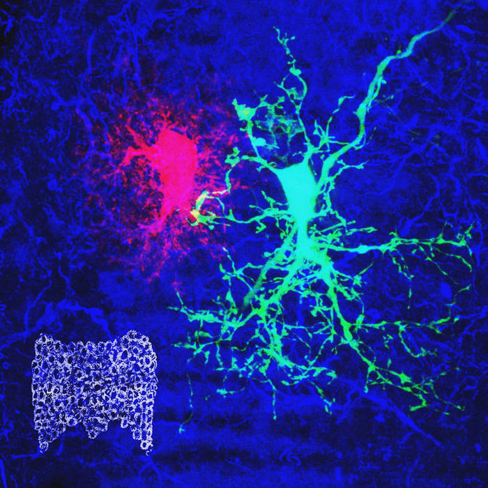 Enzyme Destroyer | Genophobic Perversion