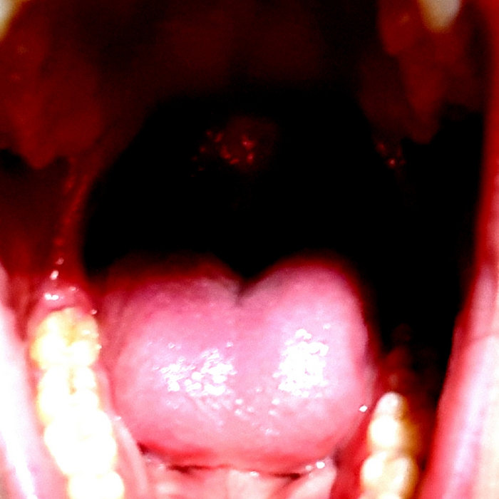 Vorarephilia | Wormb