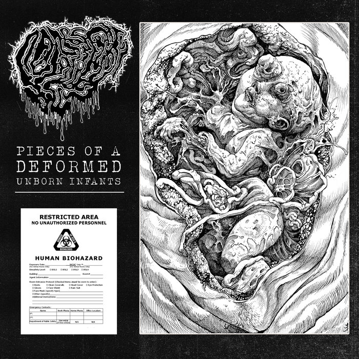 Fetal Deformity-Pieces Of A Deformed Unborn Infants ...