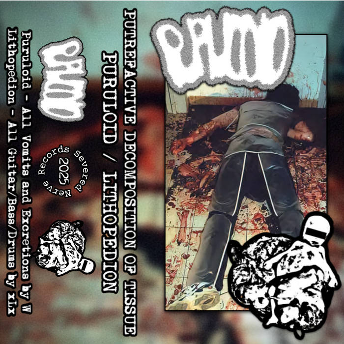 Puruloid / Lithopedion | Puruloid / Lithopedion | Severed Nerve Records