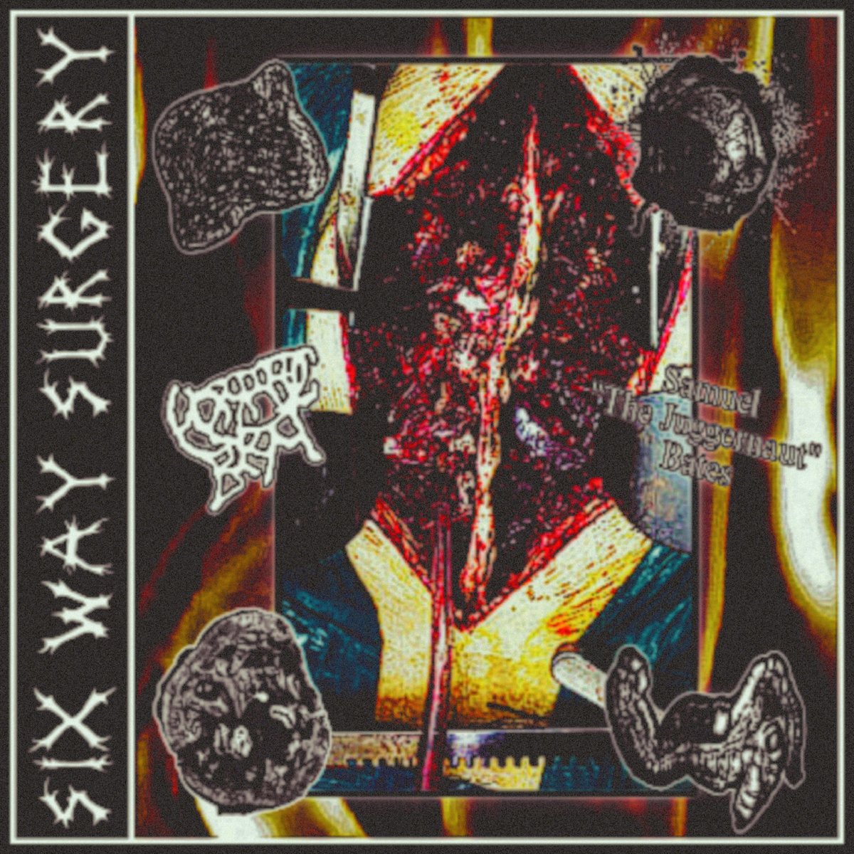 Six Way Surgery | Six Surgeons | Blood Bubbles Productions