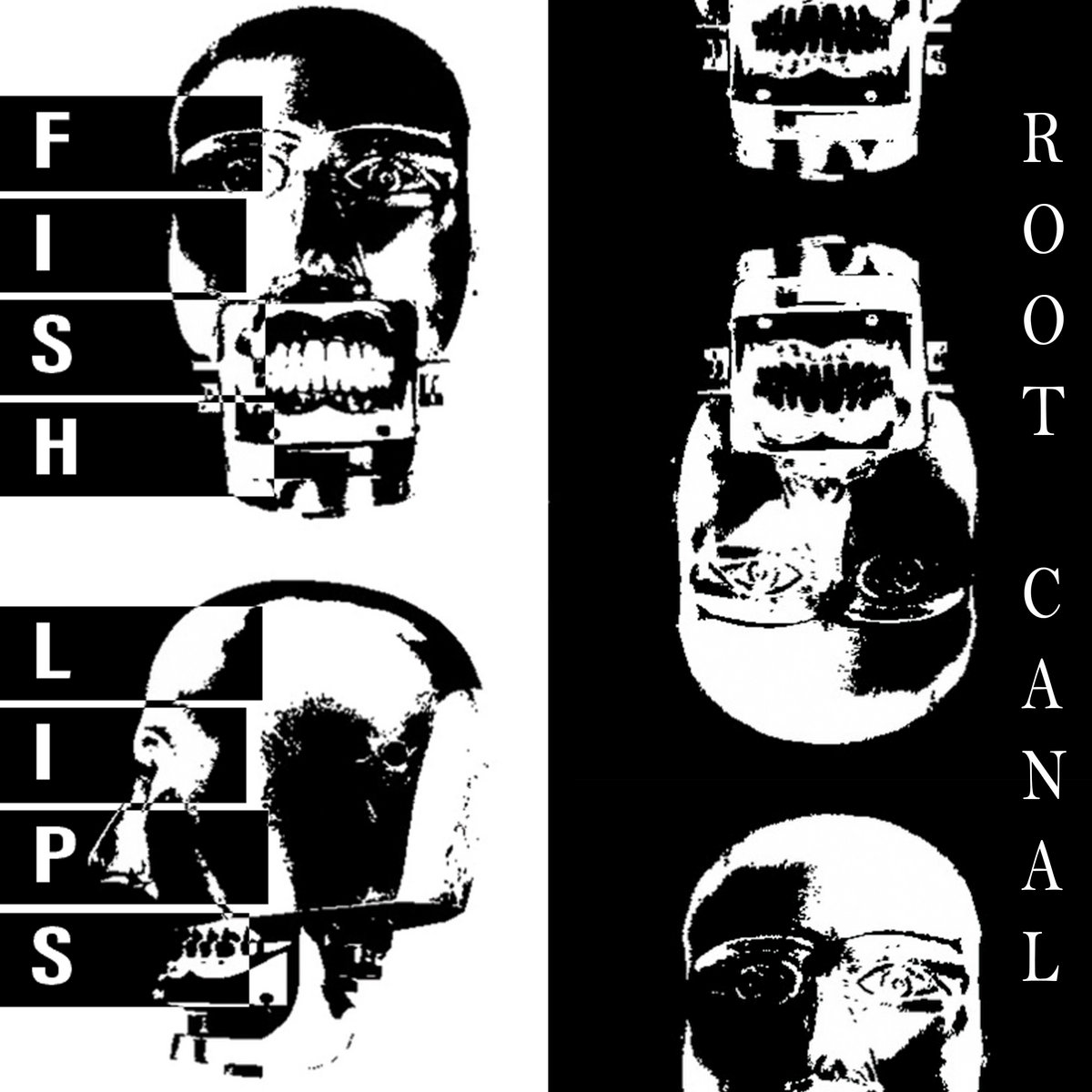 Root Canal | fishlips