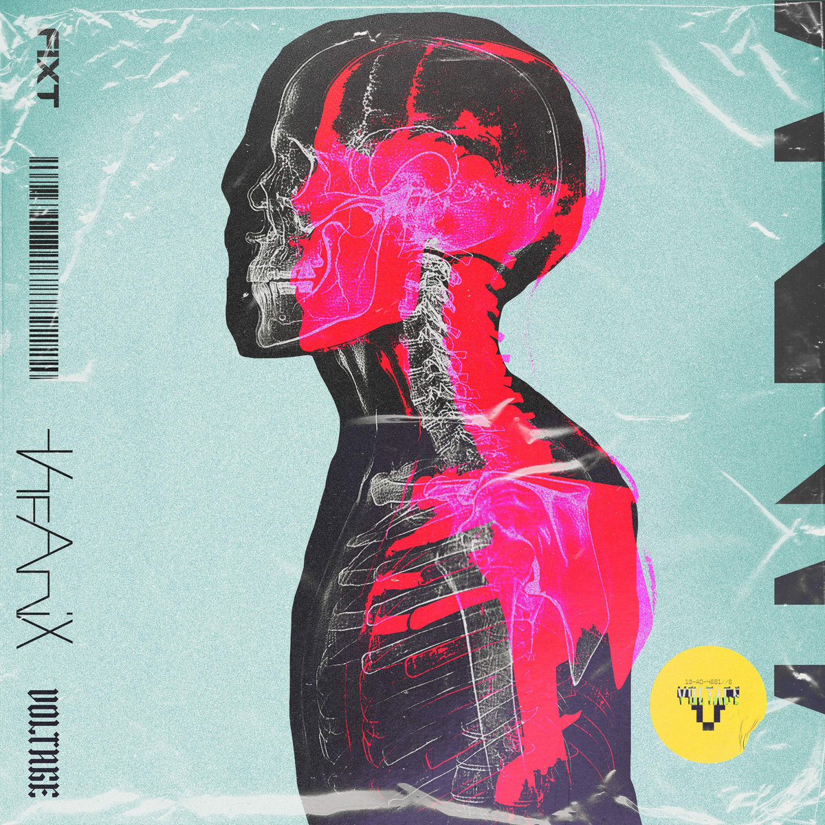 XRAY (Single) | The Anix