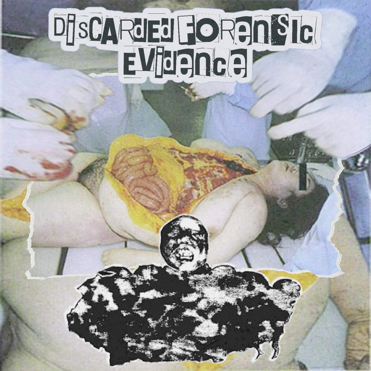 Untitled split w/Discarded Forensic Evidence | Peritoneopericardial ...