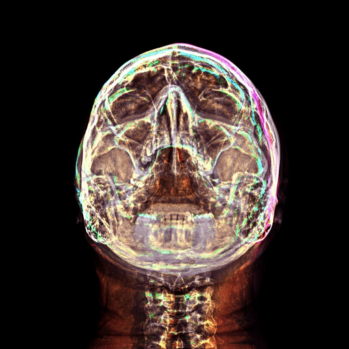 7 - HORRISONOS | Densidad Electrica