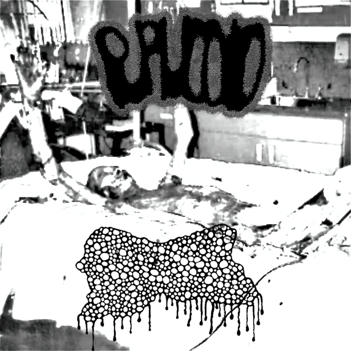 Craniofacial Degloving / Puruloid Split | Puruloid, Craniofacial ...