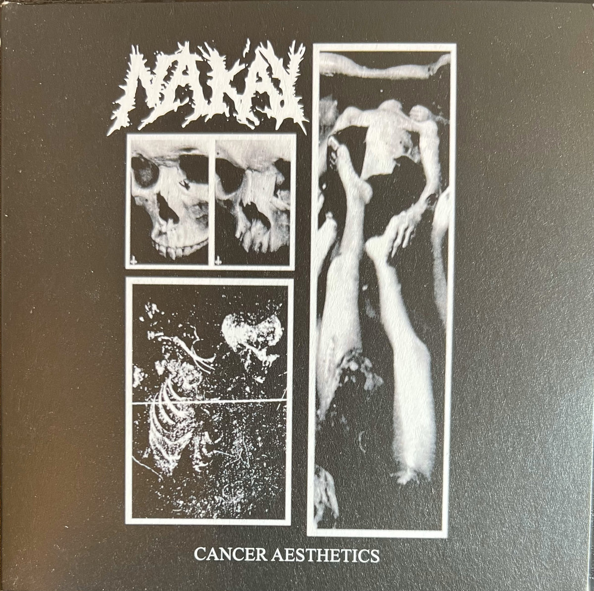 Nakay - Cancer Aesthetics | Disturbed Mind Records