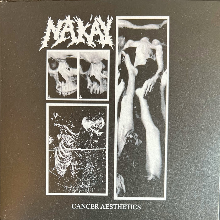 Nakay - Cancer Aesthetics | Disturbed Mind Records