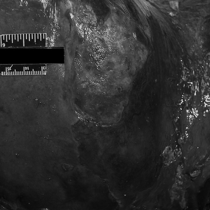 Massive Hepatic Necrosis Following Repeated Isoflurane Exposure ...
