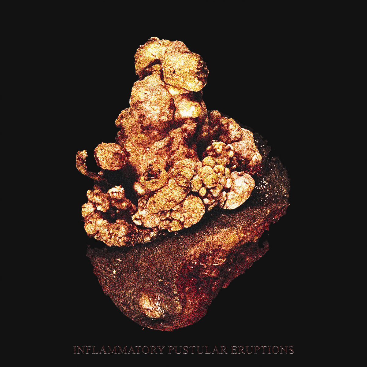 Inflammatory Pustular Eruptions | Inflammatory Pustular Eruptions ...
