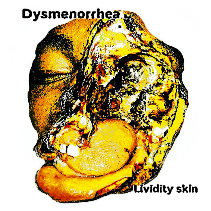 Lividity Skin | Ceruminosis Production