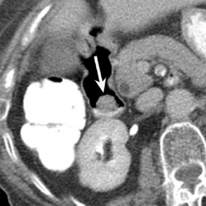 Midnight Polyps | BRAIN DEATH | DRUGBENDER