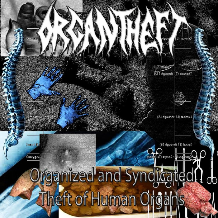 Organized and Syndicated Theft of Human Organs | Organ Theft