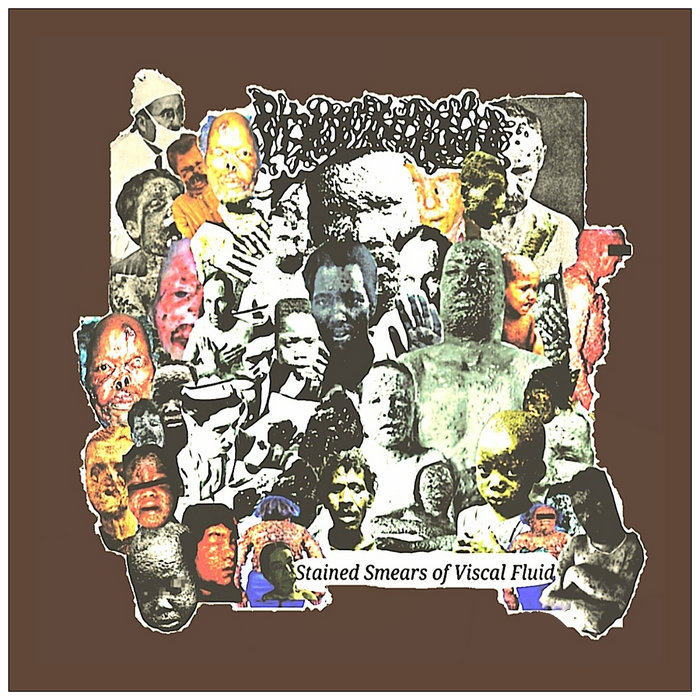 Stained Smears of Viscal Fluid | Putrefied