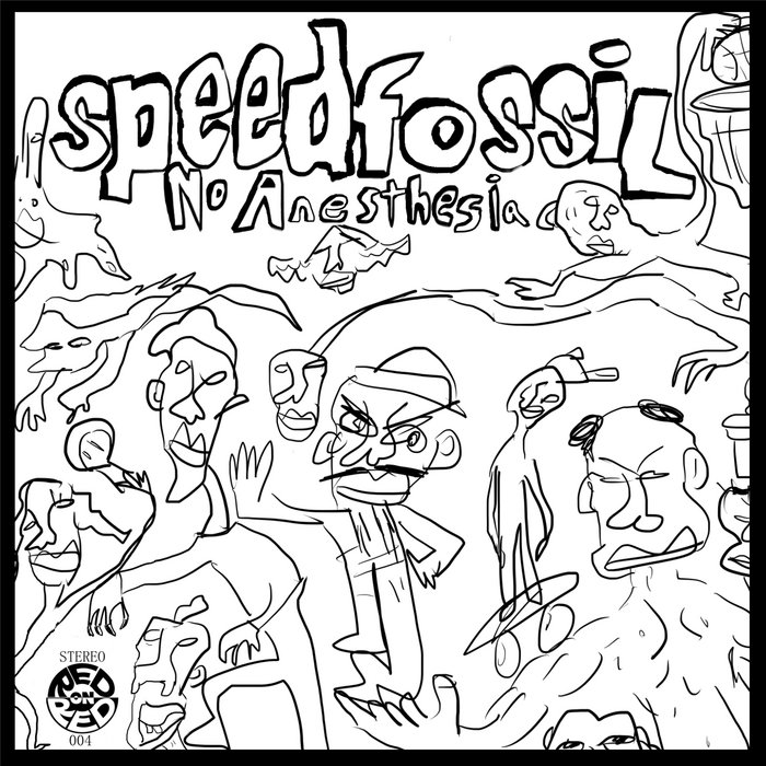 NO ANESTHESIA | Speedfossil