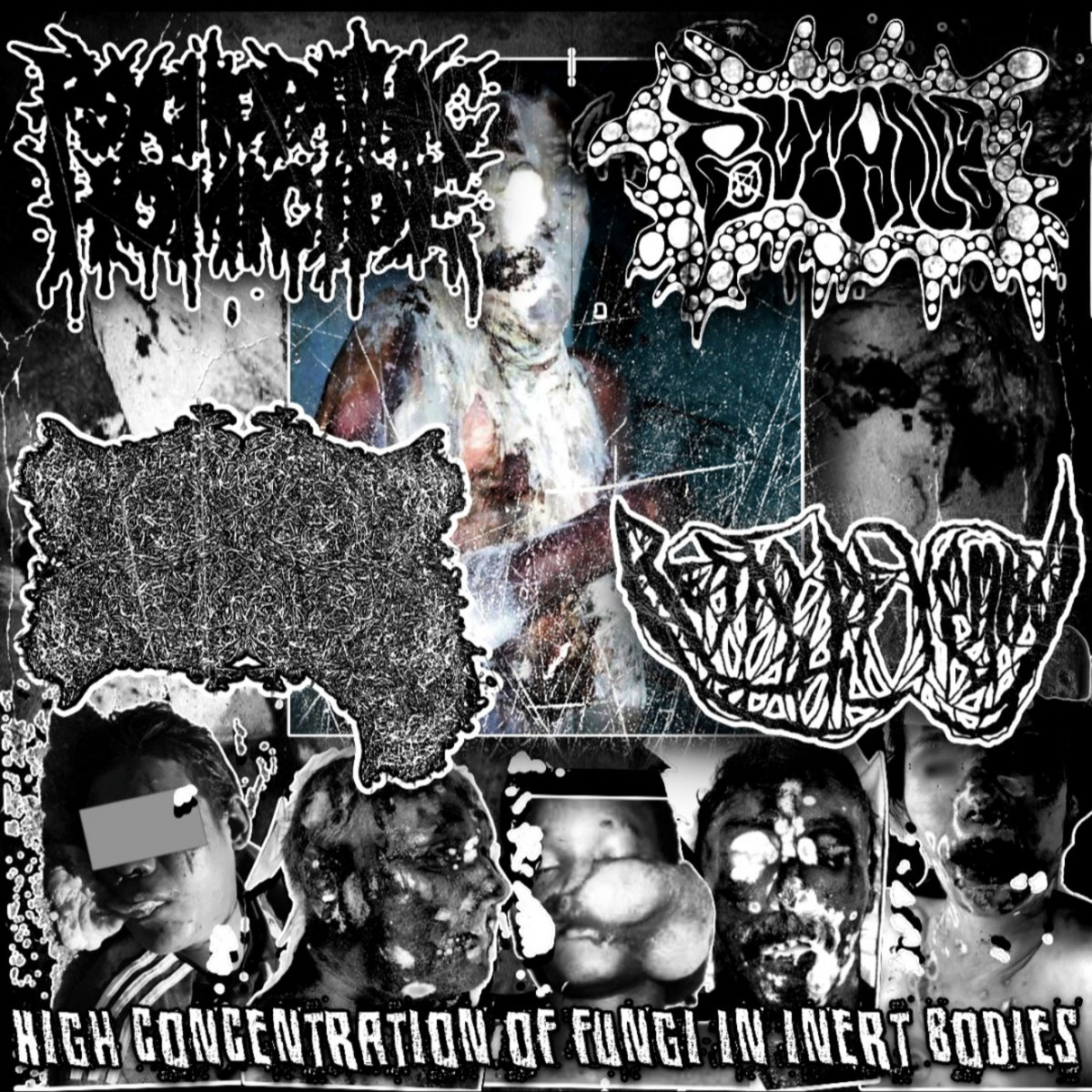 High concentration of fungi in inert bodies | Resto de vomito