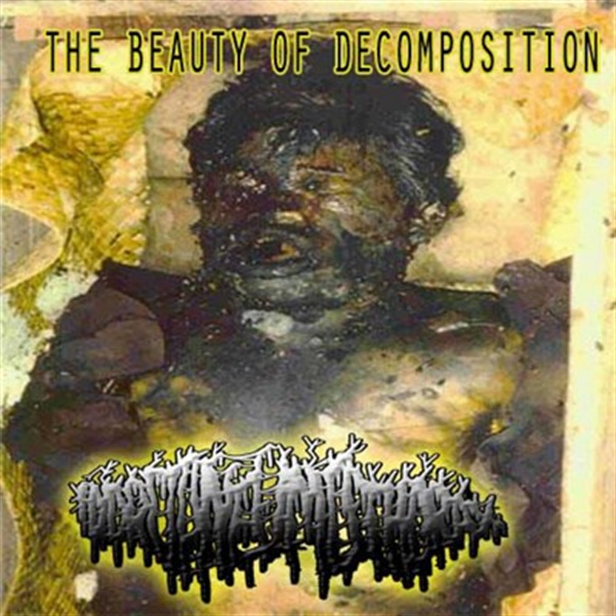The Beauty Of Decomposition | Hydropneumothorax