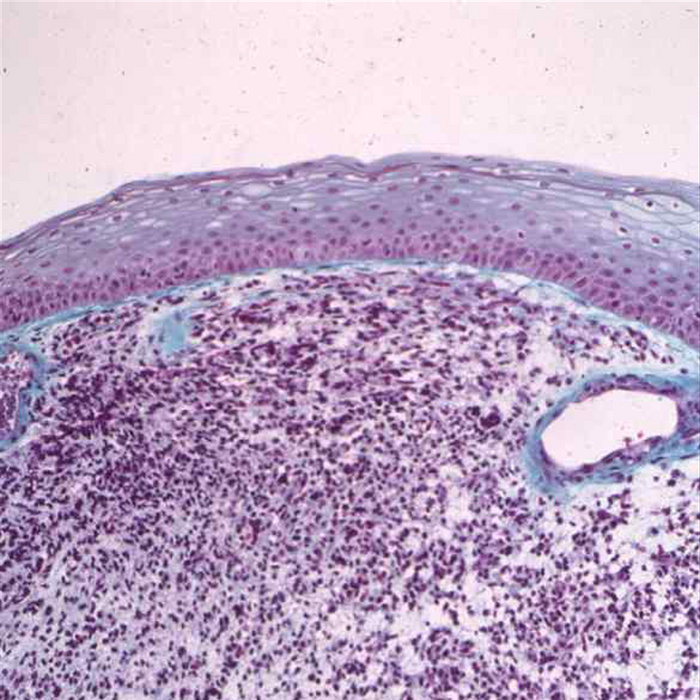 T.A.S. contra la Blenorragia (MiniMantraMedicinal) | Pre Ulzión | Ulzión