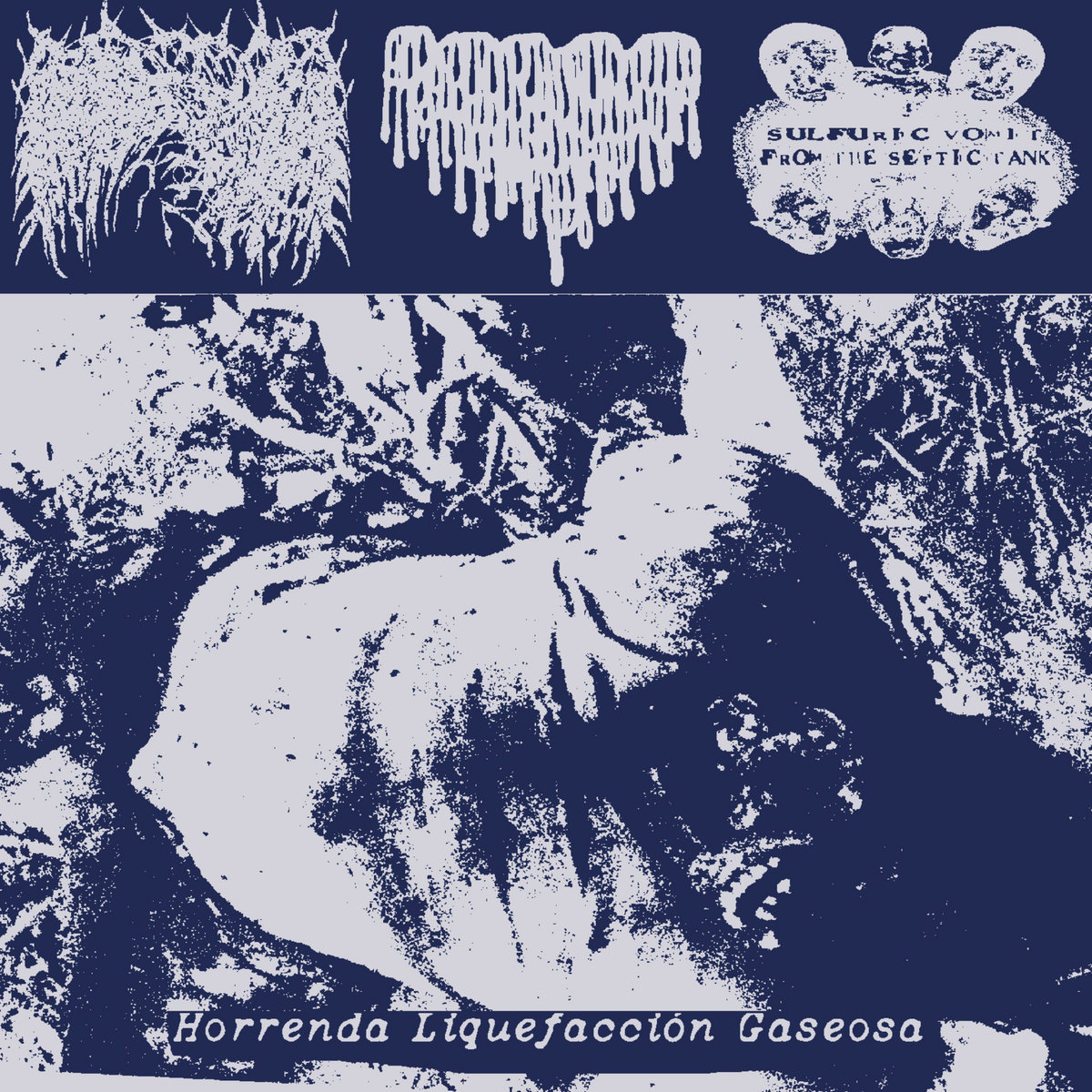 Horrenda Licuefacción Gaseosa (3 Way Split) Fetus Papyraceous ...