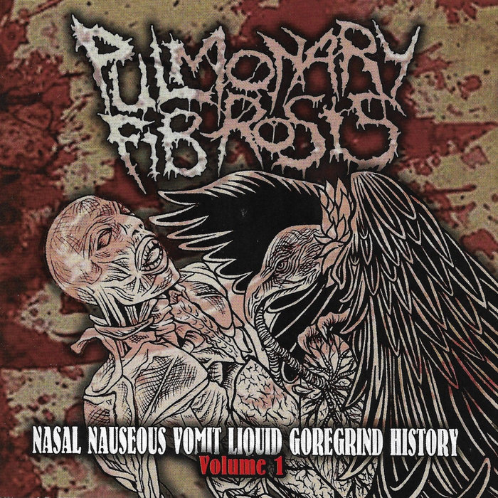 Pulmonary Fibrosis - Nasal Nauseous Vomit Liquid Goregrind History Vol ...