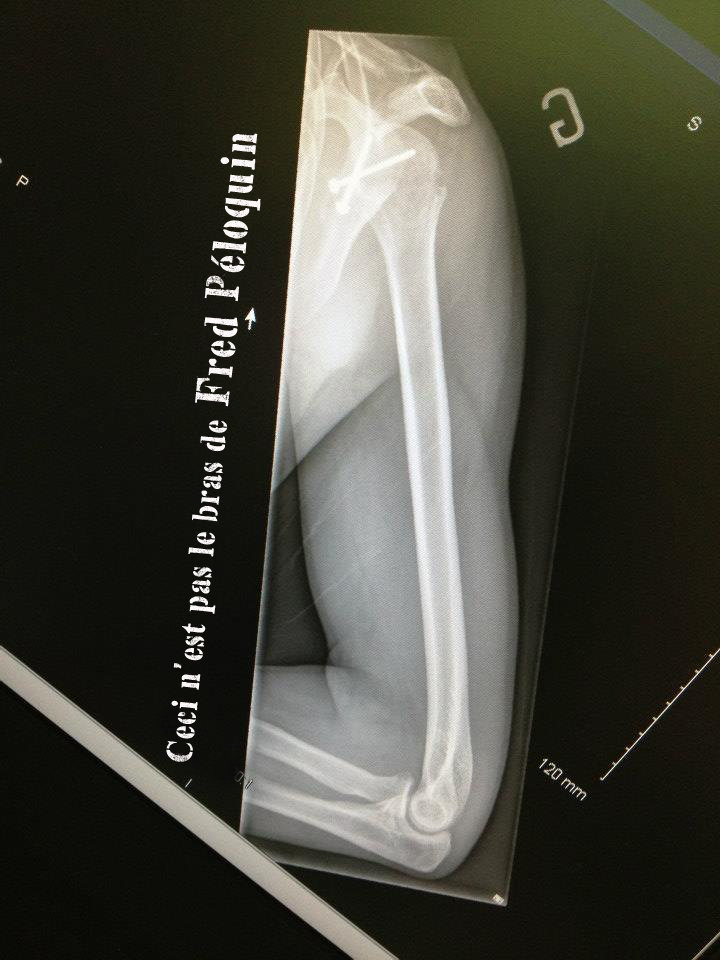 Fred Péloquin | Fred Péloquin