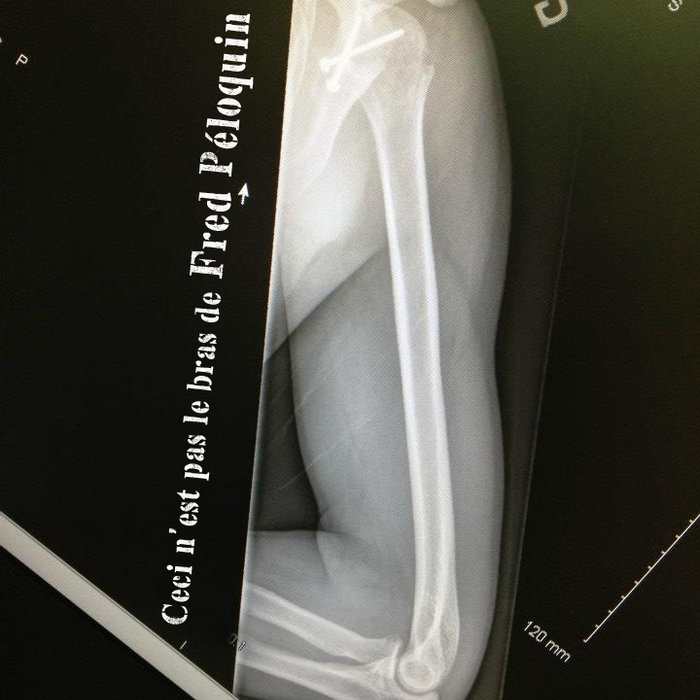 Fred Péloquin | Fred Péloquin