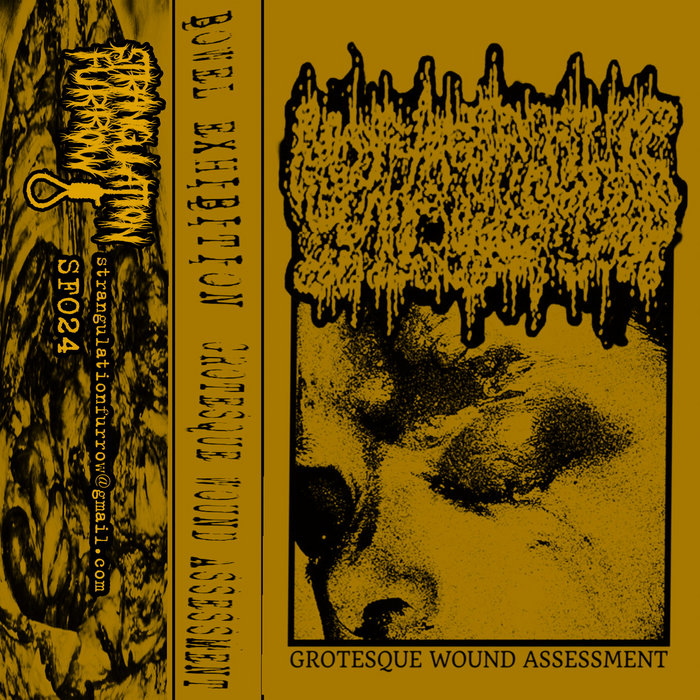 Grotesque Wound Assessment (EP) | Bowel Exhibition