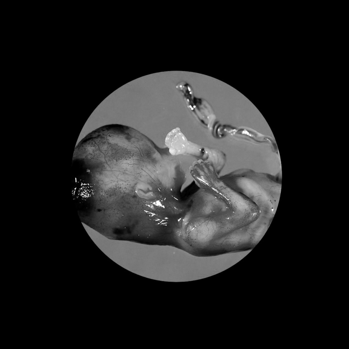 Metamorphosis | Rao Goat