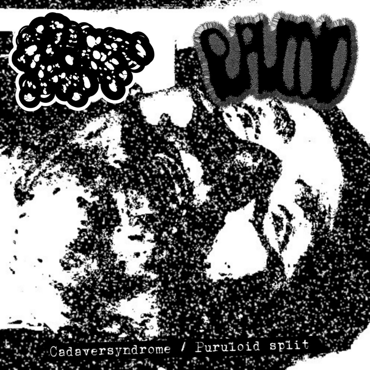 Cadaversyndrome / Puruloid split | Fuck Your Ears Records
