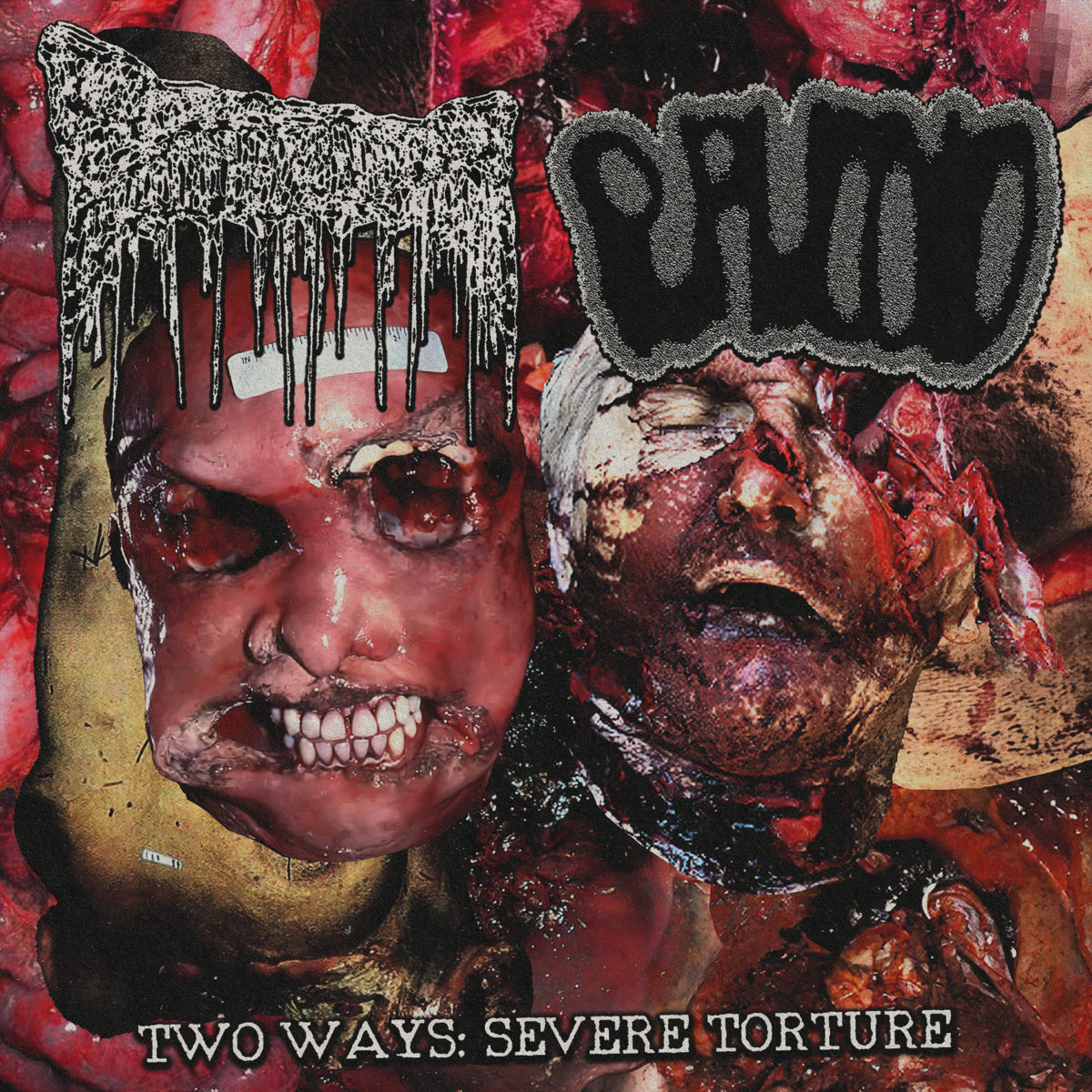 Nervous Body / Puruloid Split | Puruloid, Nervous Body | Puruloid