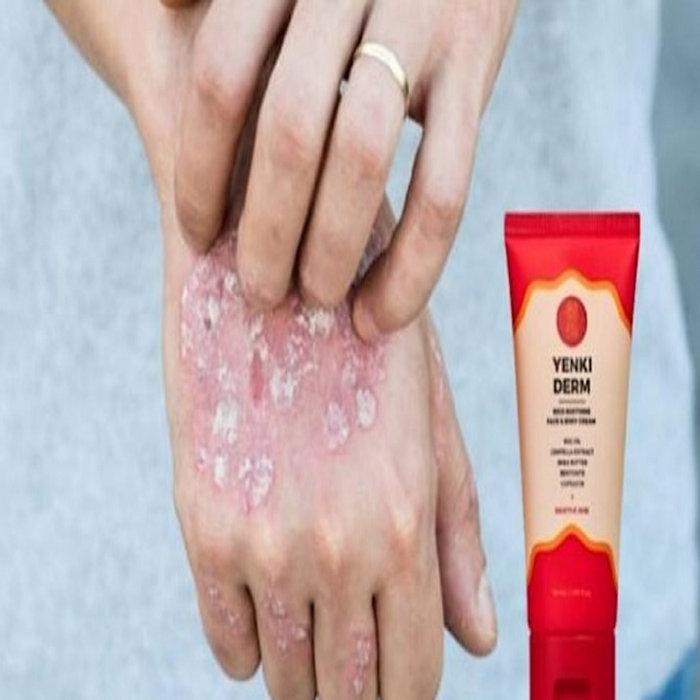 Yenki Derm: Psoriasis-Feuchtigkeitscreme! Kundenmeinungen, Preis ...
