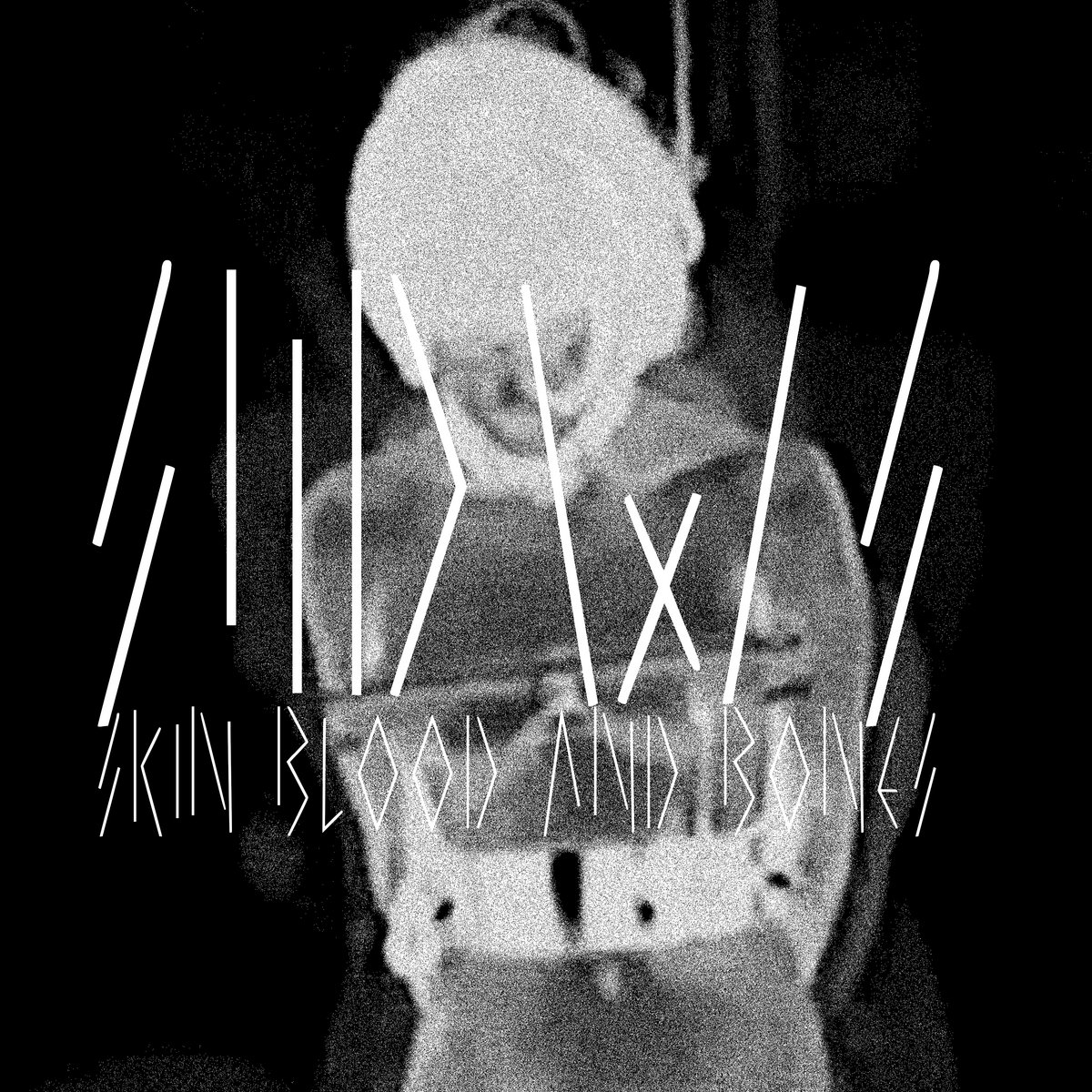 SKIN, BLOOD & BONES (ASCII.DISKO CLUB EDIT) | SHDWS | Ascii.Disko