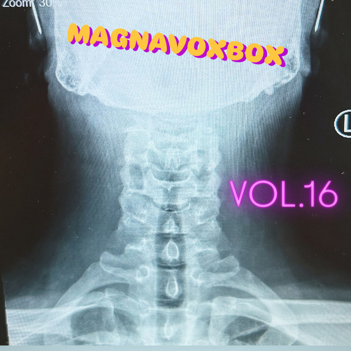 Vol. 16 | Magnavox Box