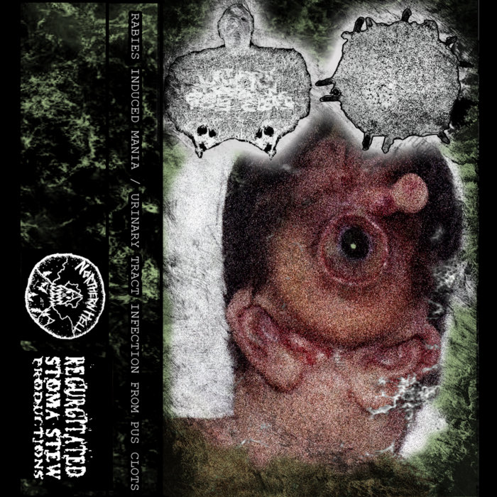 Rabies Induced Mania / Urinary Tract Infection From Severe Pus Clots ...