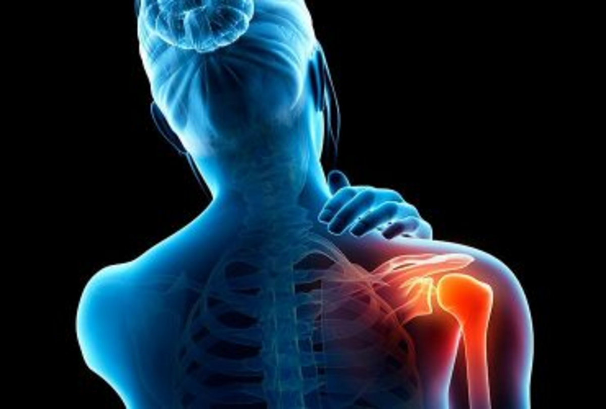 Arthrovit Arthritis Pain Relief Cream Canada | Arthrovit Arthritis Pain ...