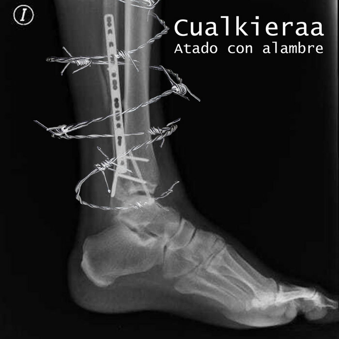 Atado con alambre | CualkierAA