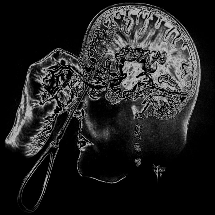 The Lobotomy | The Unseen Listener | AG319