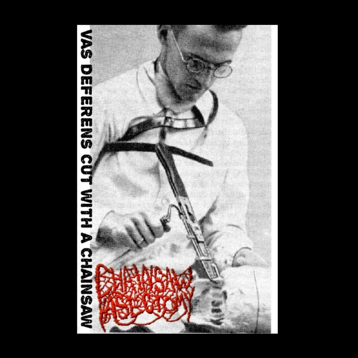 VAS DEFERENS CUT WITH A CHAINSAW | CHAINSAW VASECTOMY