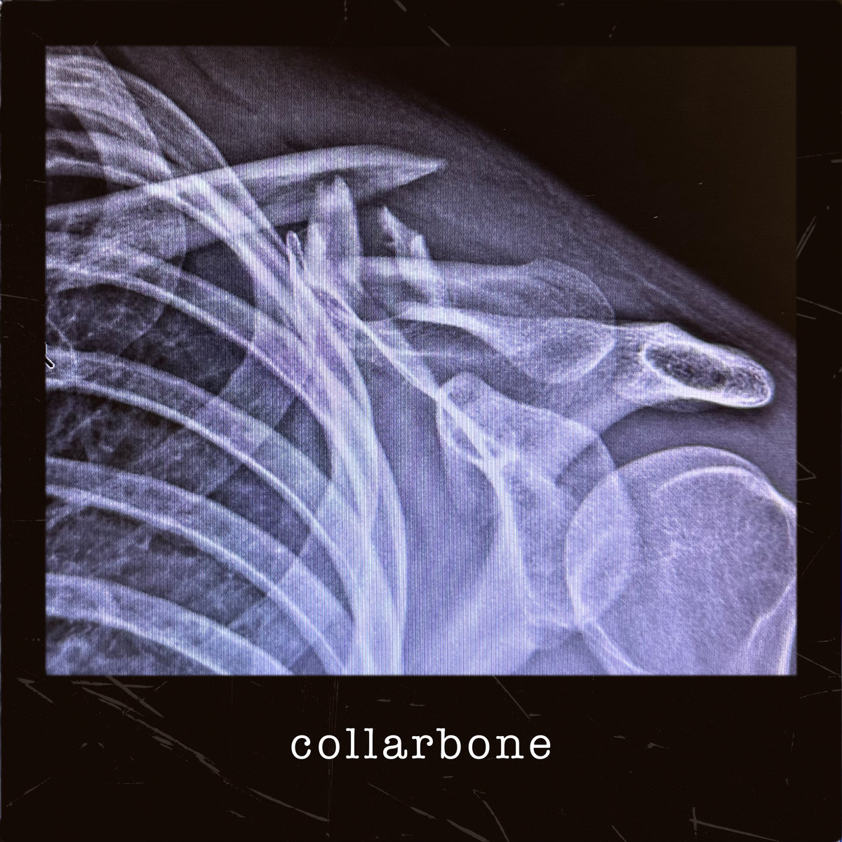 Collarbone | On Vacation