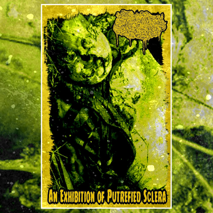 An Exhibition of Putrefied Sclera | Human Stench Rests In The Morgue