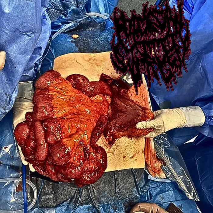 Hypothermic Instability | Hacksaw Surgery